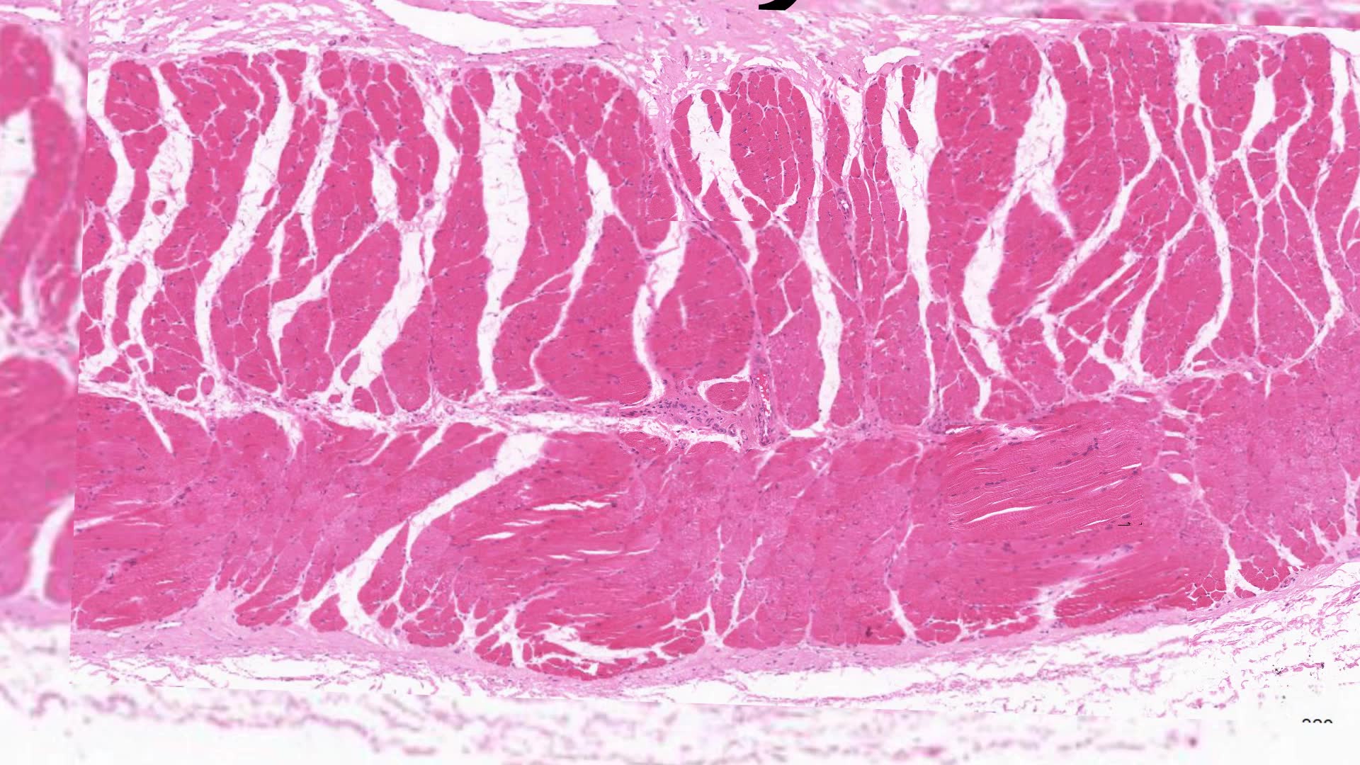 《组织学与胚胎学》实验课讲解视频—消化管—食管