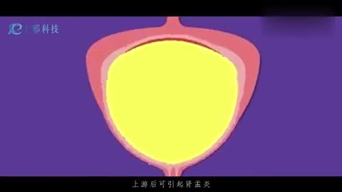 憋尿的危害很严重,你需要了解下!