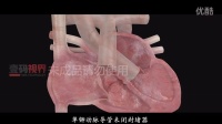 先心封堵器动画成品0913(心脏原色).wmv