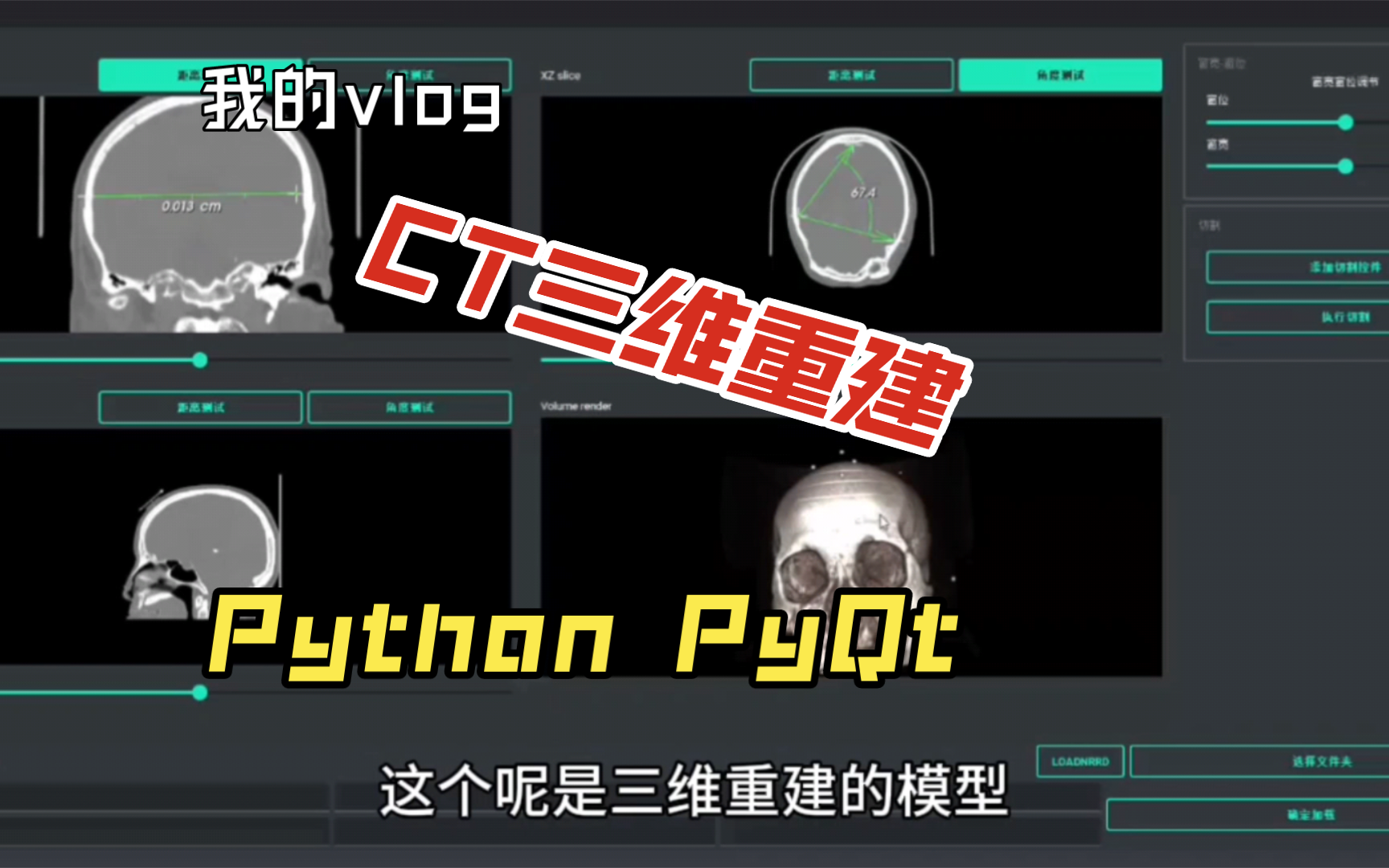 Python PyQt CT三维重建,CT数据导入包围框切割,虚拟切割,模型导出