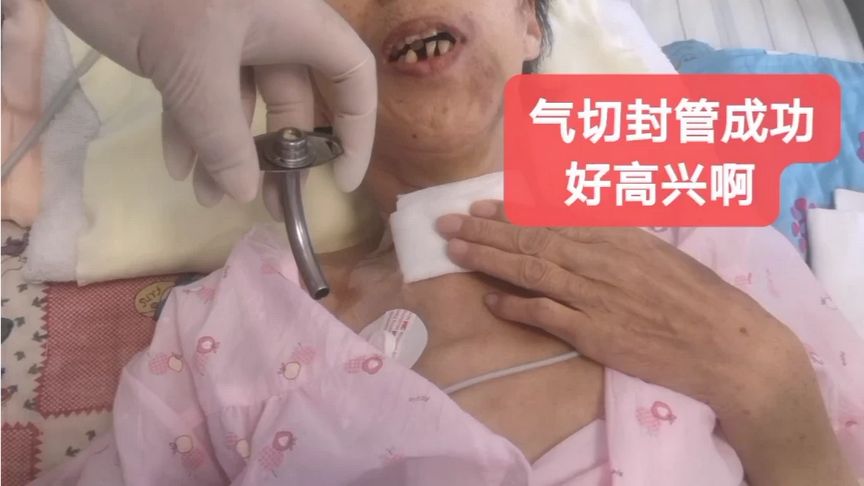 气切封管成功,我要走回家