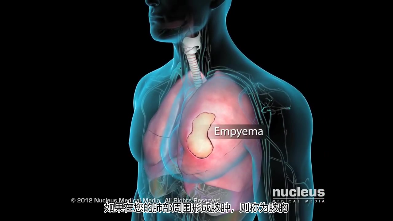 【中英】肺炎 三维医学动画 p1中文p2英文Pneumonia