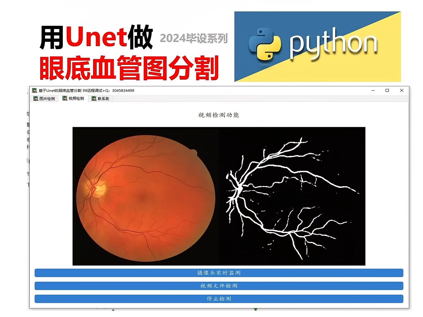 【大作业-14】手把手教你用Unet做眼底血管图像分割