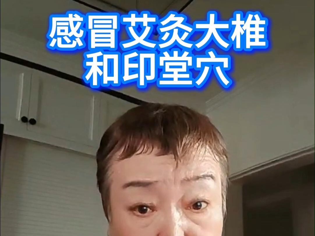 感冒艾灸大椎和印堂穴