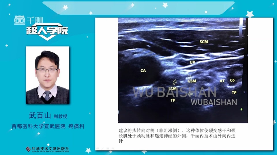 2.超声引导颈椎疼痛治疗:星状神经节阻滞(二)