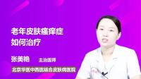 老年皮肤瘙痒症如何治疗?医生为你支招
