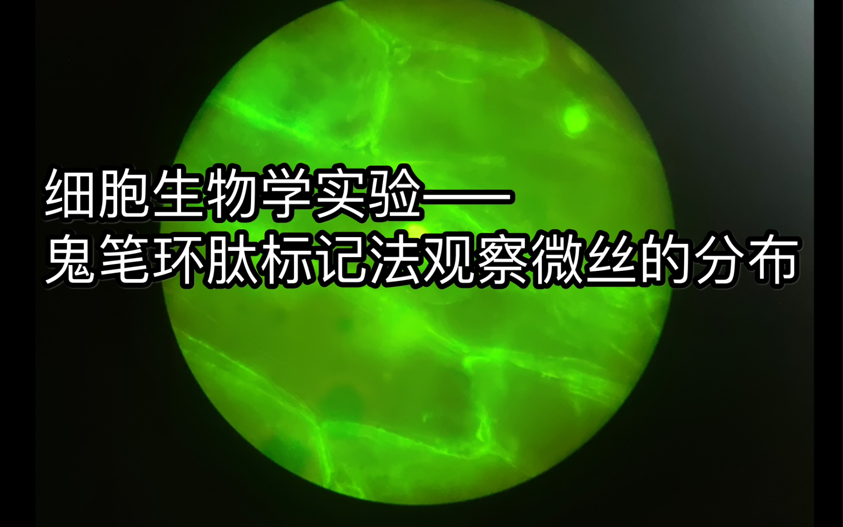 细胞生物学实验——鬼笔环肽标记法观察微丝的分布