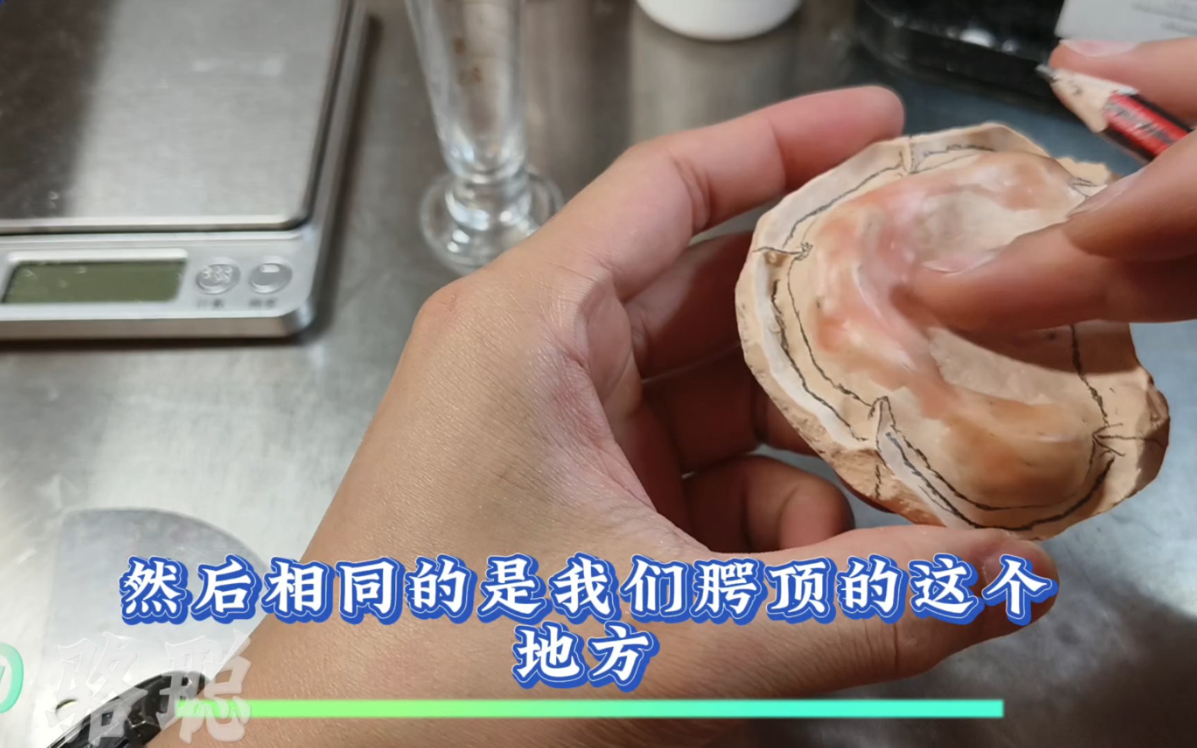 活动全口义齿之个性化托盘的两种制作方式与上颌蜡提制作