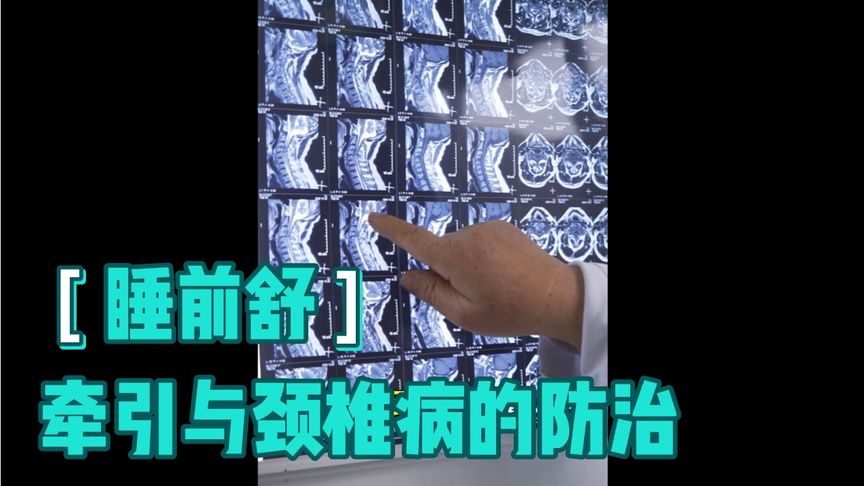 为什么教科书里说牵引是治疗颈椎病的重要手段?