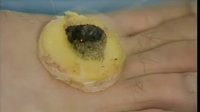 温灸疗法 温灸盒使用 艾灸棒使用 随身灸使用