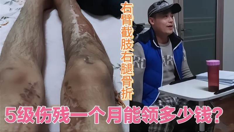 小董车祸致5级伤残一个月可以享受多少补贴怎么申请办理残疾证