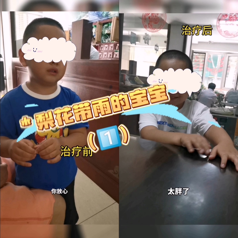 支原体肺炎的中医治疗(一)