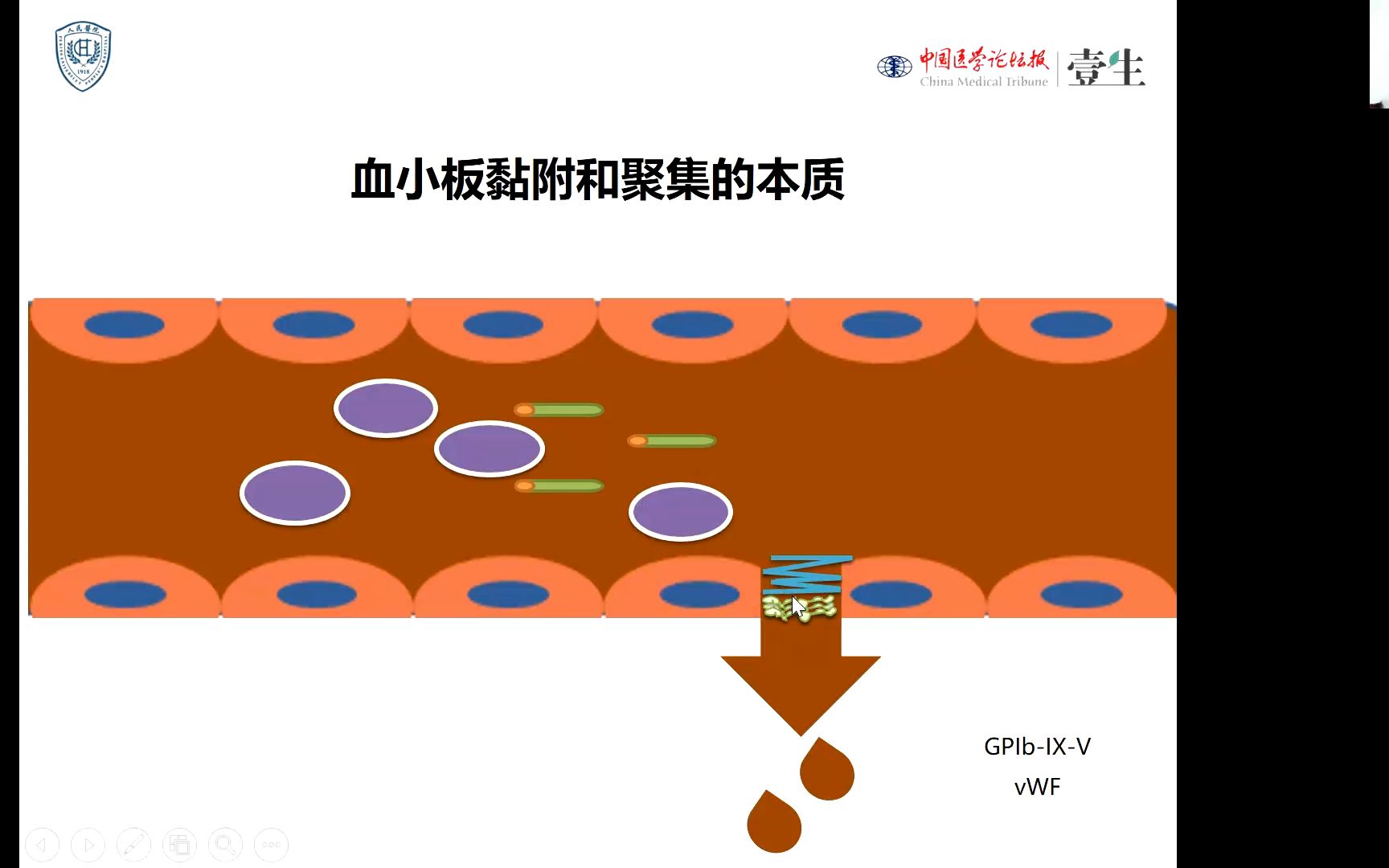 出凝血训练营4 TEG血栓弹力图解析