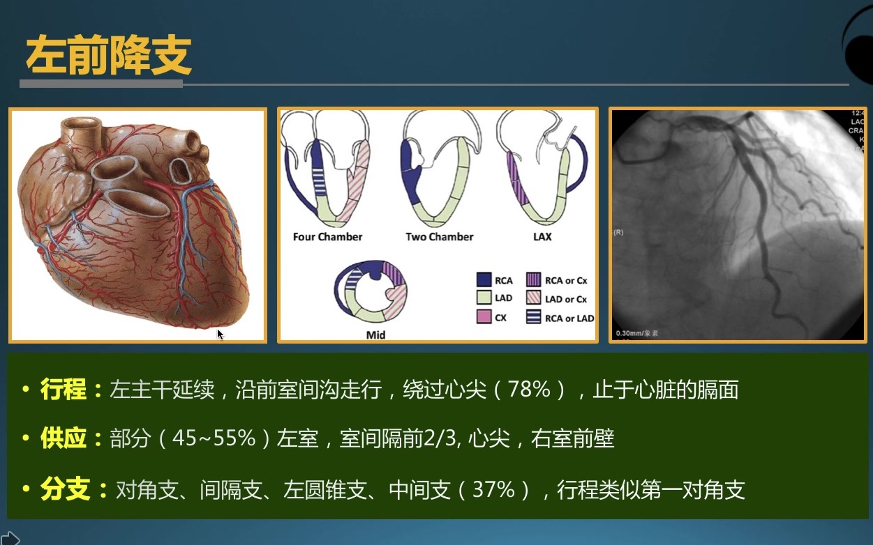 冠状动脉造影入门操作-孔令秋博士手把手教学系列
