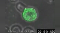 60秒让你看清艾滋病毒如何入侵免疫细胞的