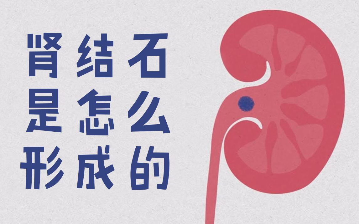 【TED-Ed】肾结石是怎么形成的 @柚子木字幕组