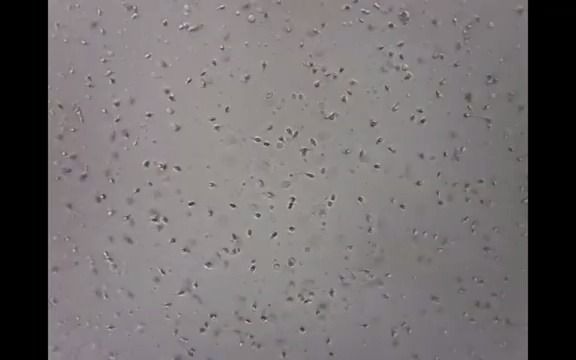 显微镜下观察精液中的精子