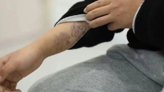 果然发布|任何企业、组织和个人不得向未成年人提供文身服务