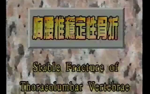 胸腰椎稳定性骨折,剪辑自1994年《中国骨伤学》,添加字幕供中医骨伤...