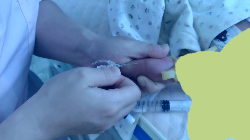 新生儿留置针#单手留置针#新生儿护士