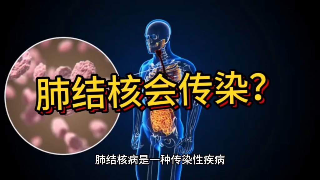 肺结核会传染吗 #肺结核 #肺结核患者