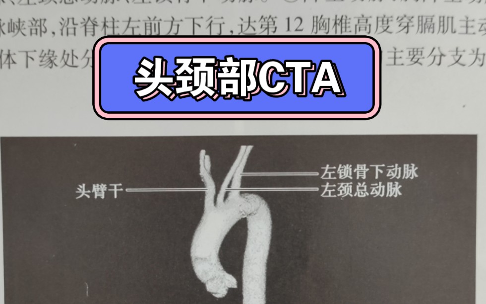 颈部血管CTA分享(包含颅脑血管MRA)