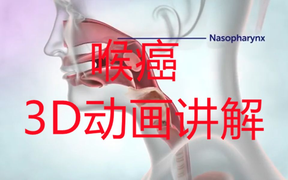 喉癌-3D医学科普动画