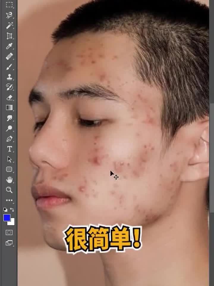 #ps 去除脸部痘痘,然后就可以. #设计 #p图