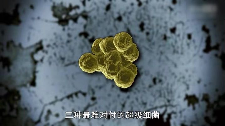 抗击超级细菌病毒,你对抗生素有多少了解?