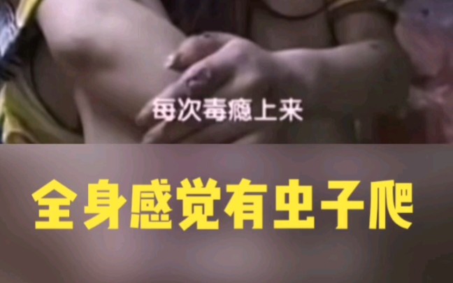 恐怖!20岁女子毒瘾发作,痛苦不堪。