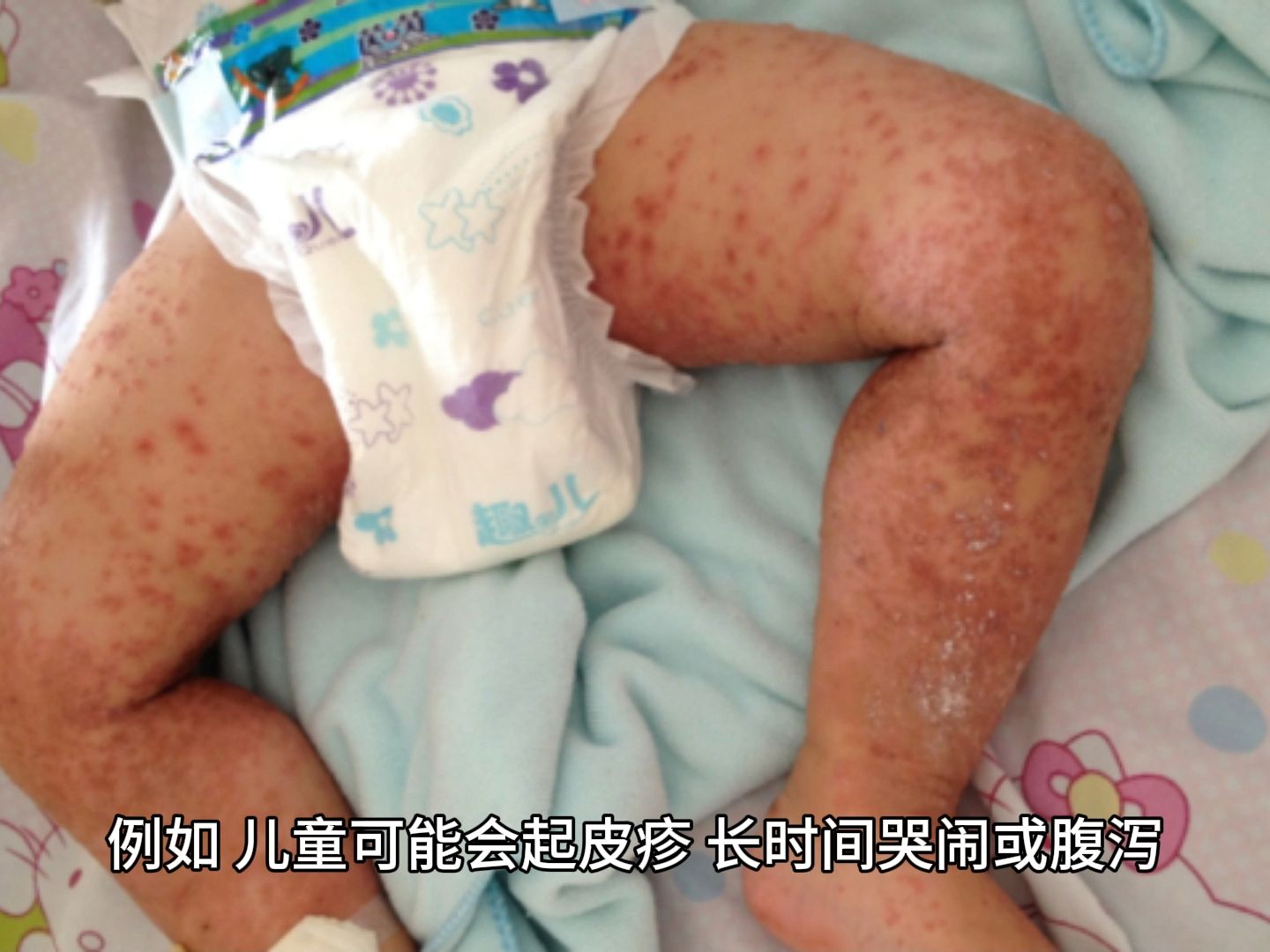 为啥不建议用柔顺剂