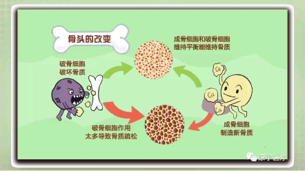 超声波骨密度分析仪报告单怎么看?0
