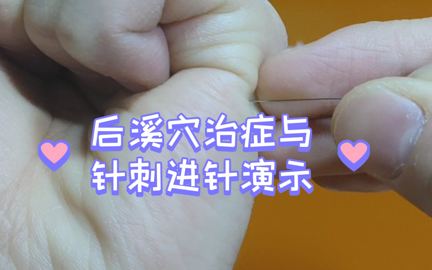 后溪穴治症分享与针刺进针演示