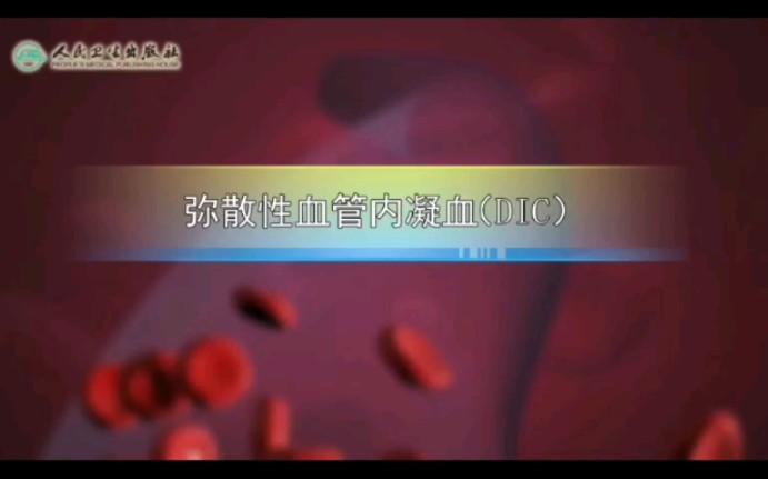 【病理生理学】弥散性血管内凝血(DIC)