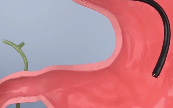 长春医院治疗胃病-长春新安胃肠病医院好不好