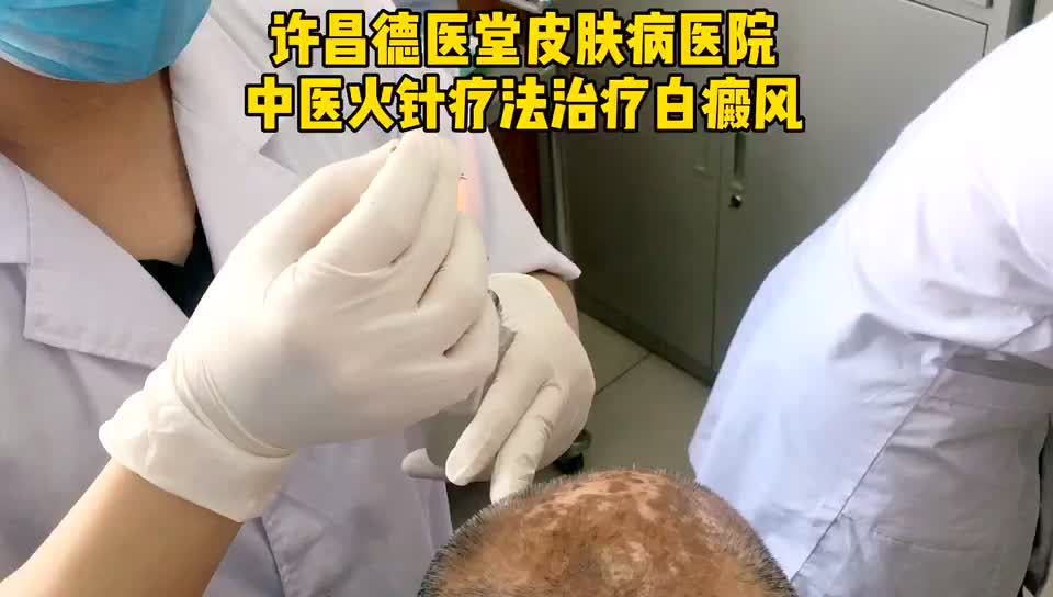 ...一种集针和灸两种方法为一体的方法,既有针调和气血疏通经络的作用,...