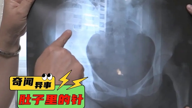 女人的肚子里藏了根针,是根缝衣服的针