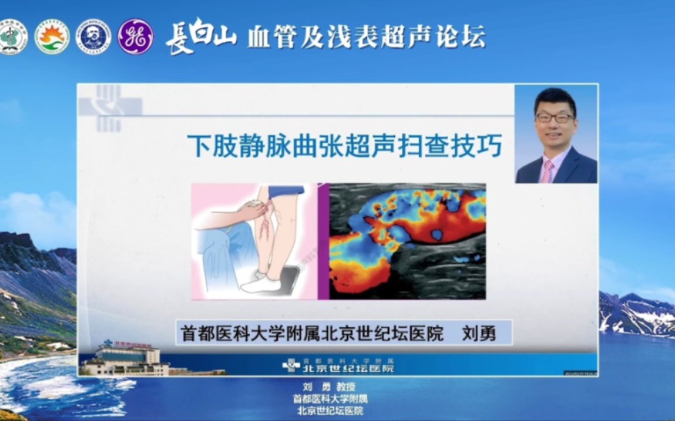 下肢静脉曲张超声扫查技巧2