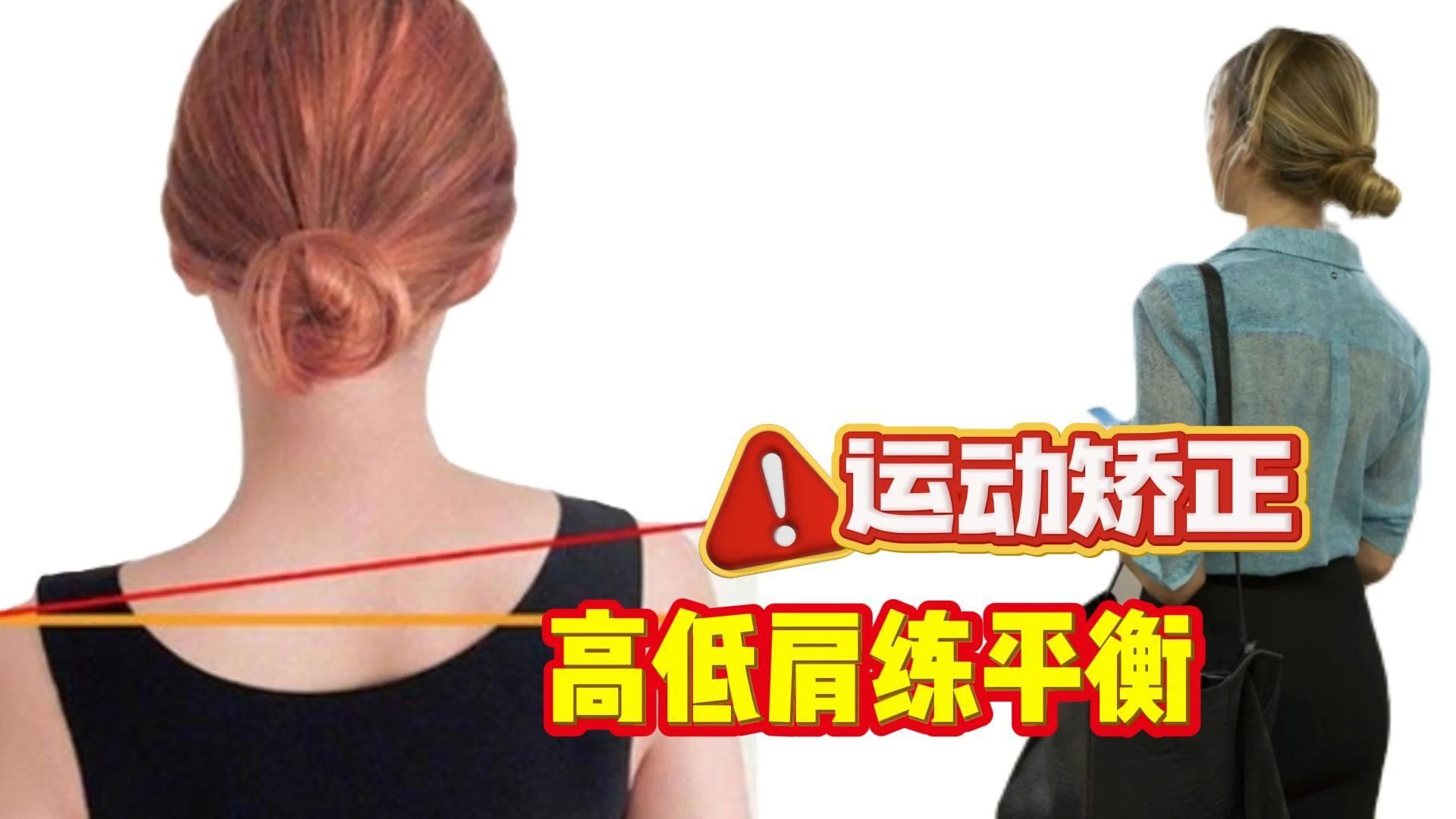 运动矫正|高低肩练平衡