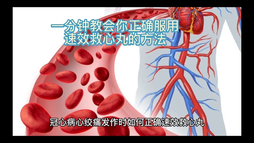 一分钟教会你正确服用速效救心丸的方法