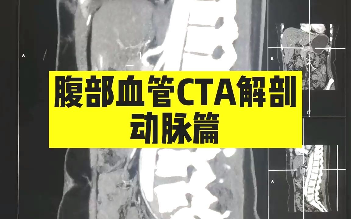 腹部血管CTA解剖,腹腔干、肠系膜上动脉,肝总、固有,十二指肠
