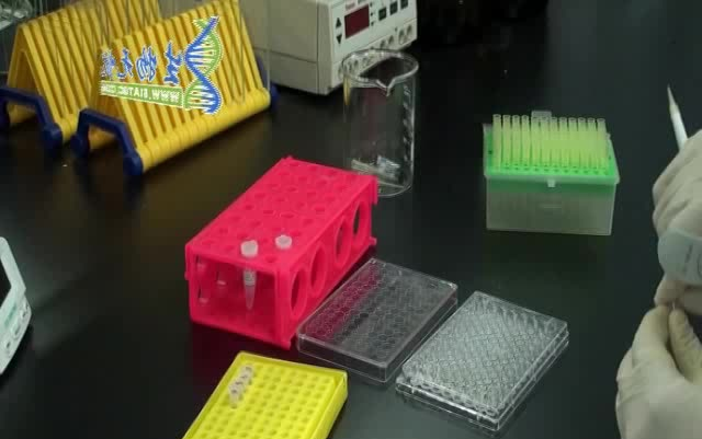 【生物科研实验】Western blot实验原理及实操,导师再也不用担心我的...