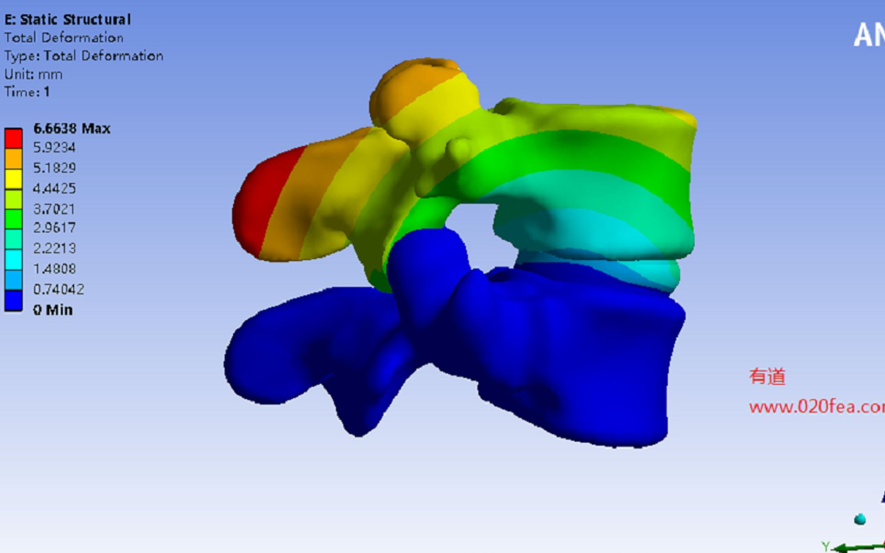 腰椎-怎么做医学3D建模和生物力学分析呢?流程讲解