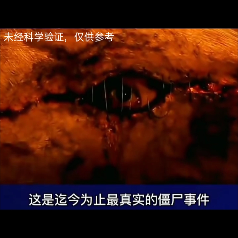 世界上最恐怖的僵尸事件