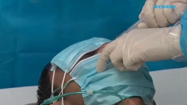 #呼吸内镜 #支气管镜检查 #气管镜 #国产