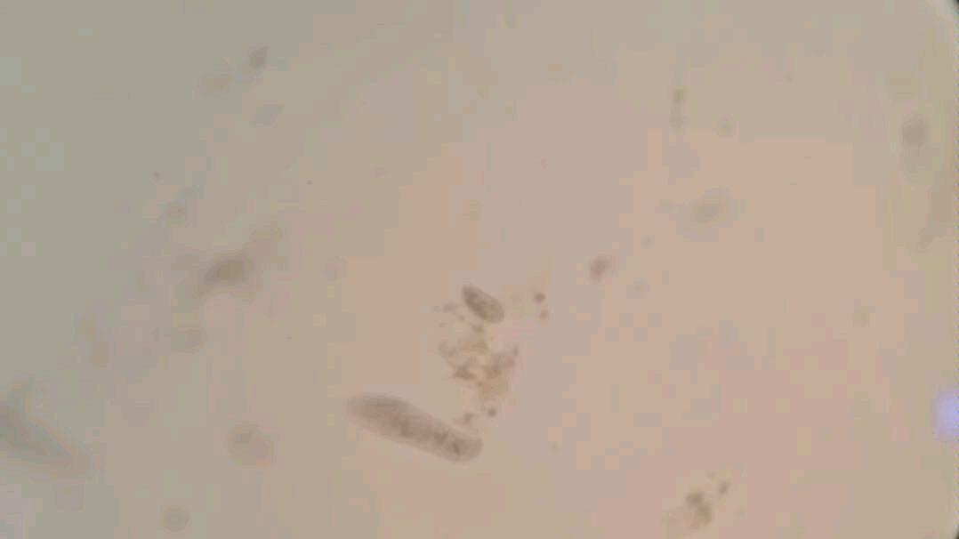 震惊,某大学生居然用显微镜观察这种不可描述的事情