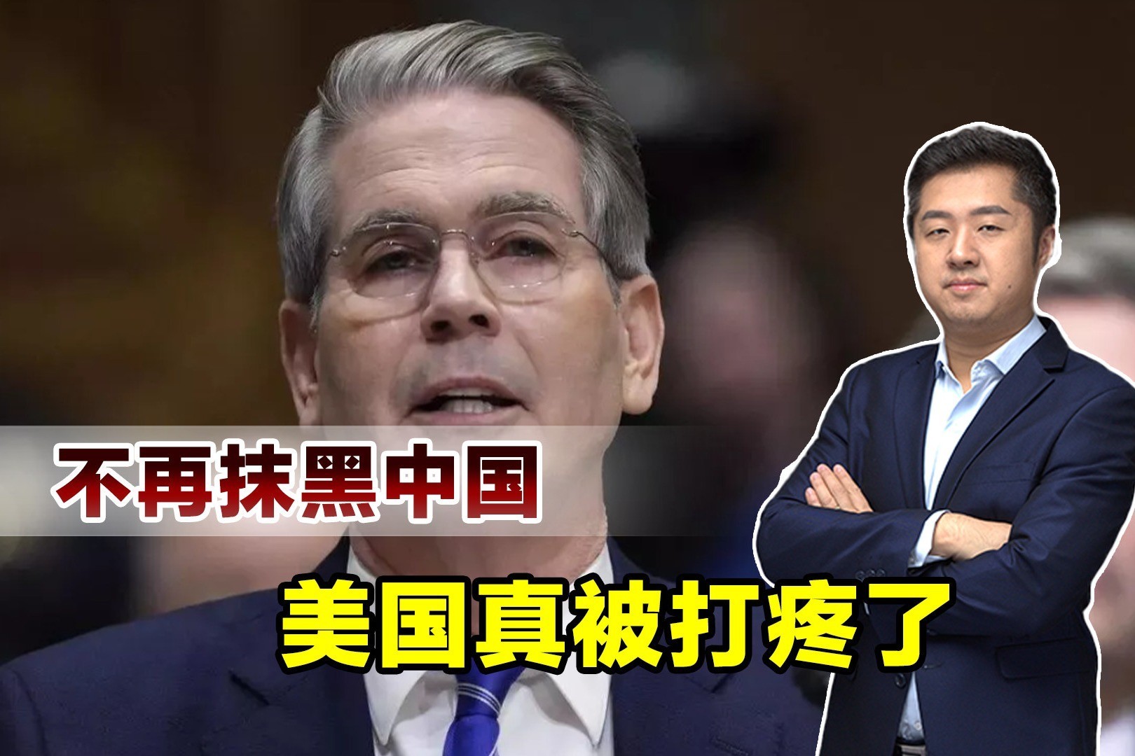 美国真的被打疼了,连CNN都老实了,不再无脑抹黑中国