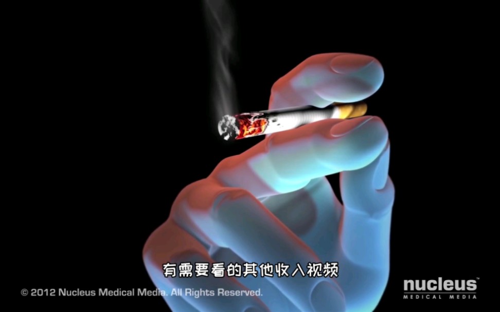 吸烟危害(二),导致心脑血管疾病原因,3D演示。