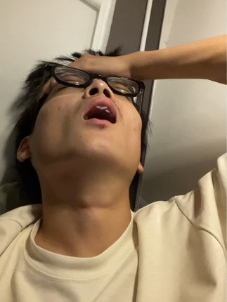 一个视频告诉你一型糖尿病控糖有多难! #vlog日常 #一型糖尿病