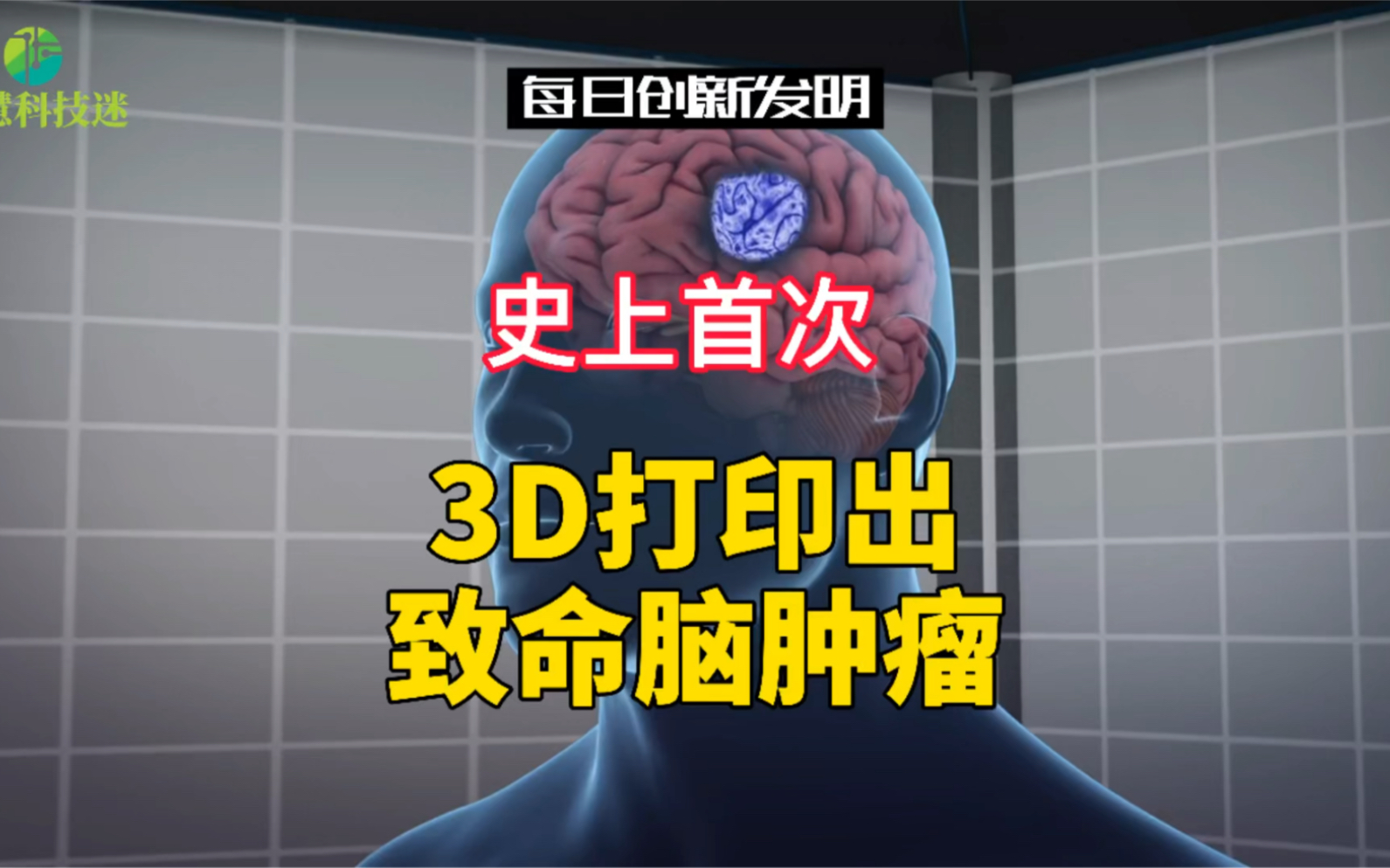 史上首次3D打印出致命脑肿瘤,或有助于开发新治疗方法